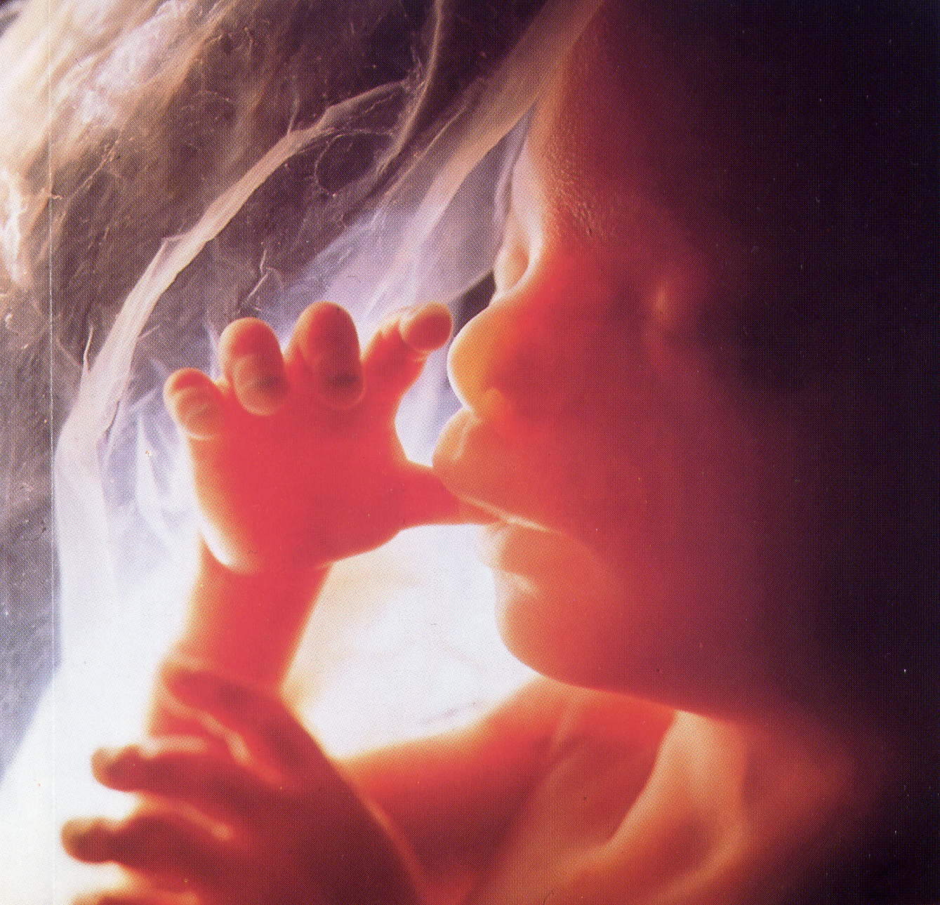 Life is Precious